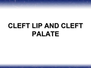 CLEFT LIP AND PALATE.pptx