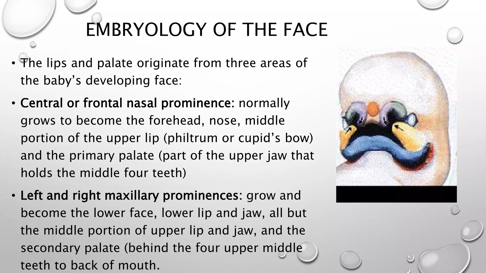 Cleft lip and palate.ppt