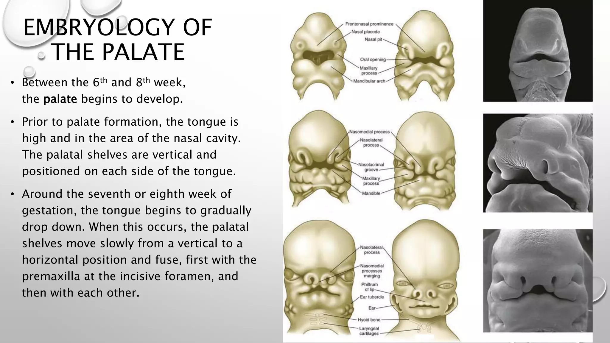 Cleft lip and palate.ppt
