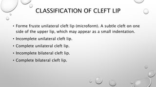 Cleft lip and palate.ppt