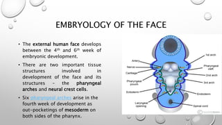Cleft lip and palate.ppt