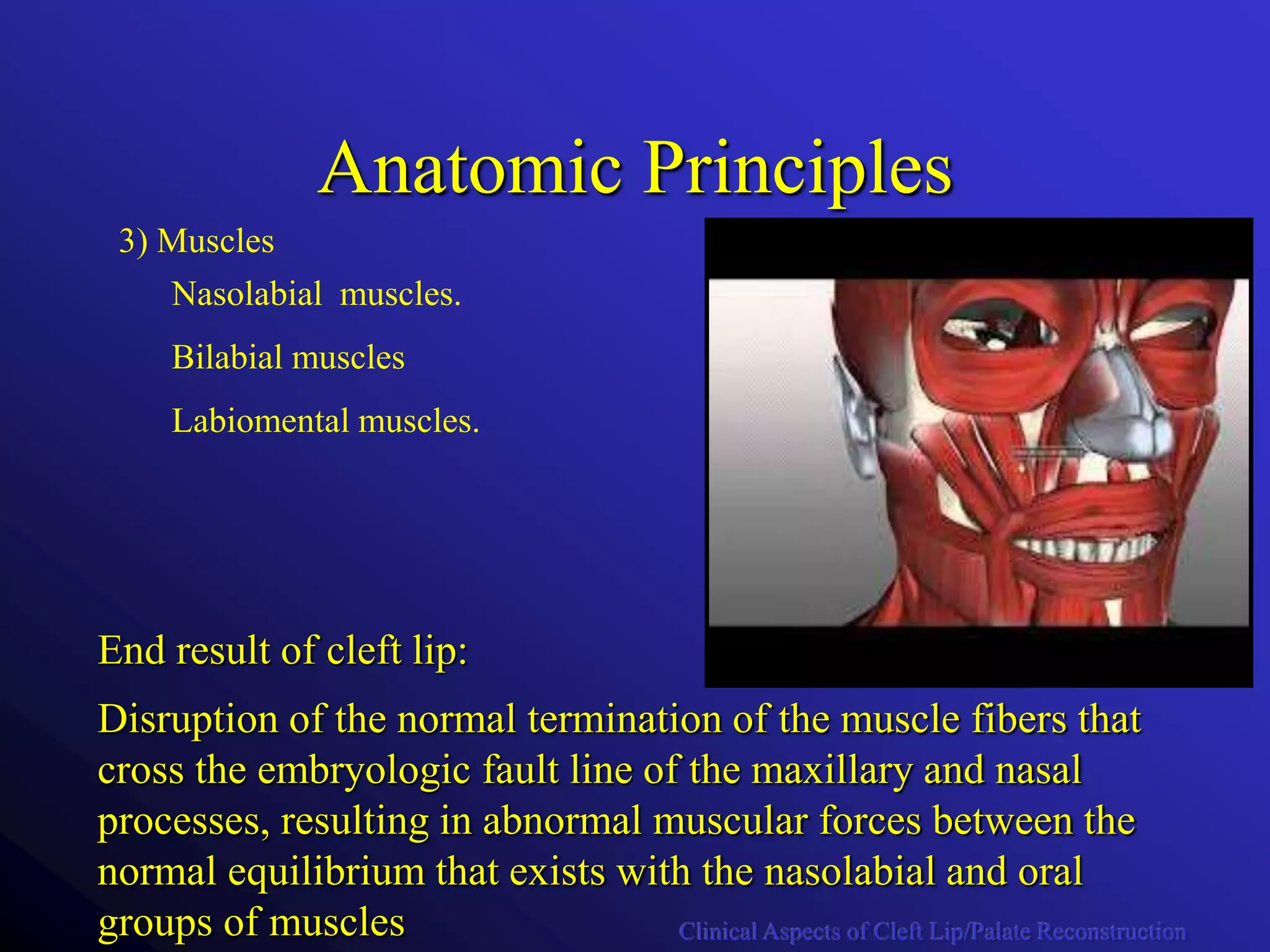 Cleft lip and palate.pptx