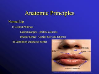 Cleft lip and palate.pptx