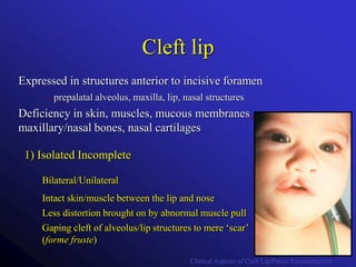 Cleft lip and palate.pptx