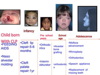 CLEFT LIP AND PALATE.ppt