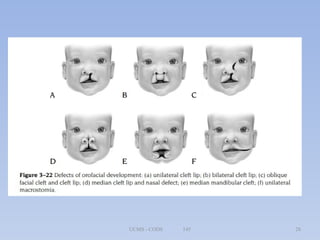Cleft lip and Palate Management and Treatment | PPTX