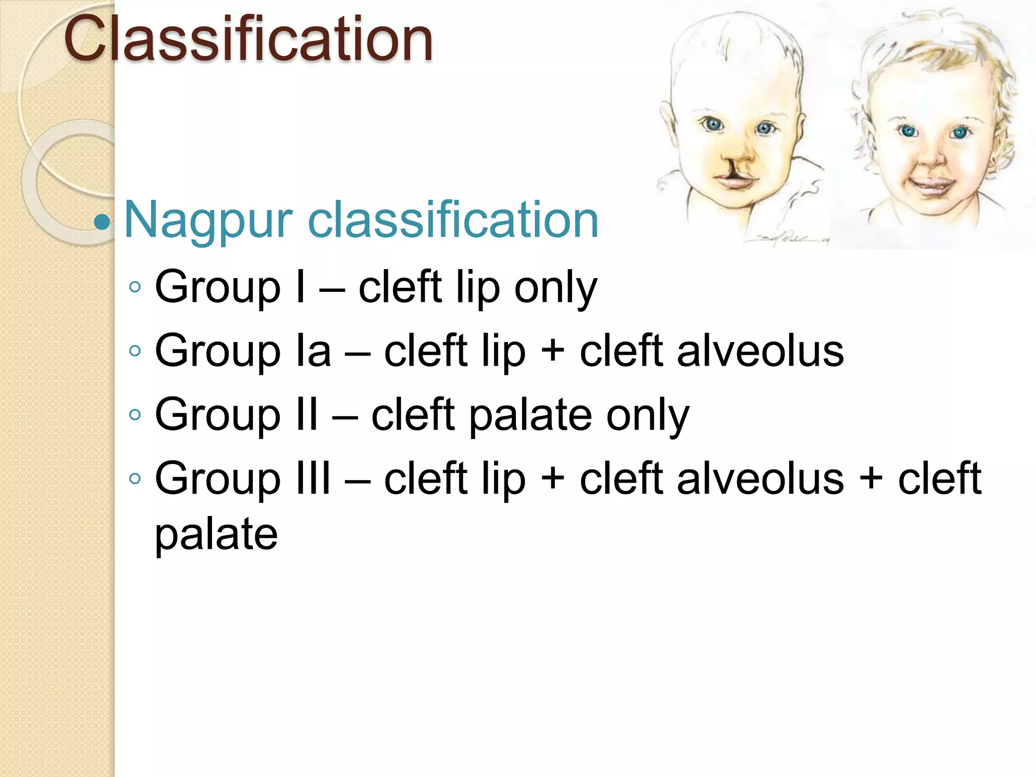 Cleft lip and palate basics | PPTX