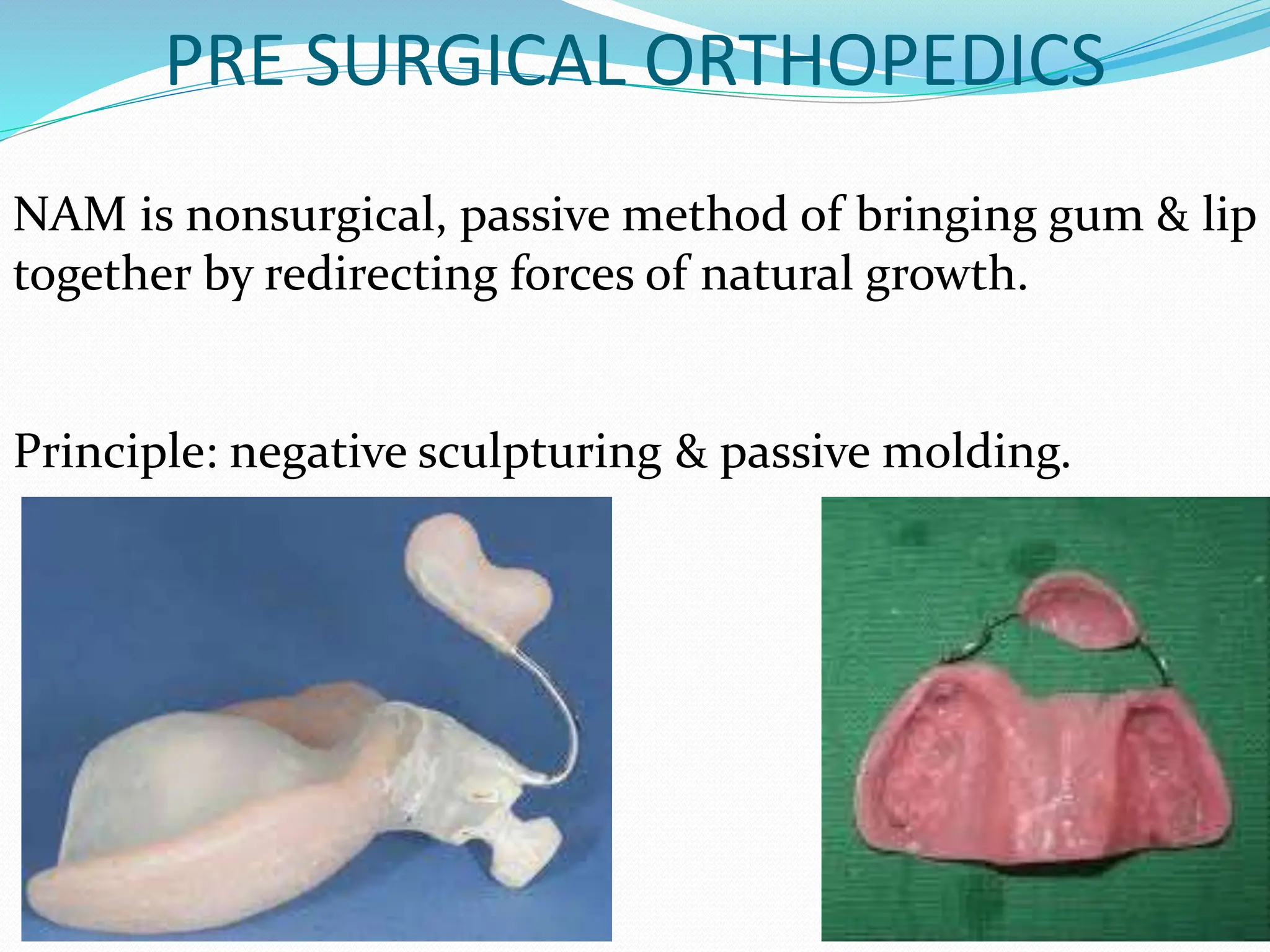 CLEFT LIP AND PALATE craniofacial anomalies | PPTX