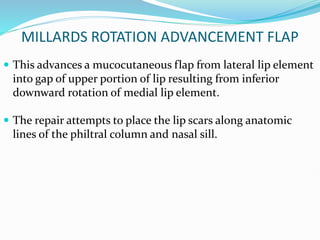 CLEFT LIP AND PALATE craniofacial anomalies | PPT