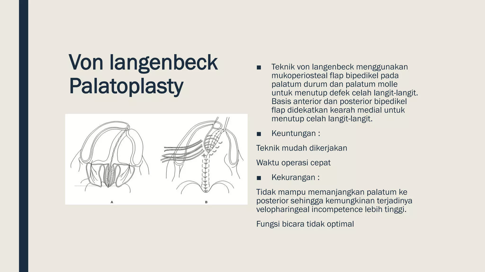 Cleft lip and palate | PDF