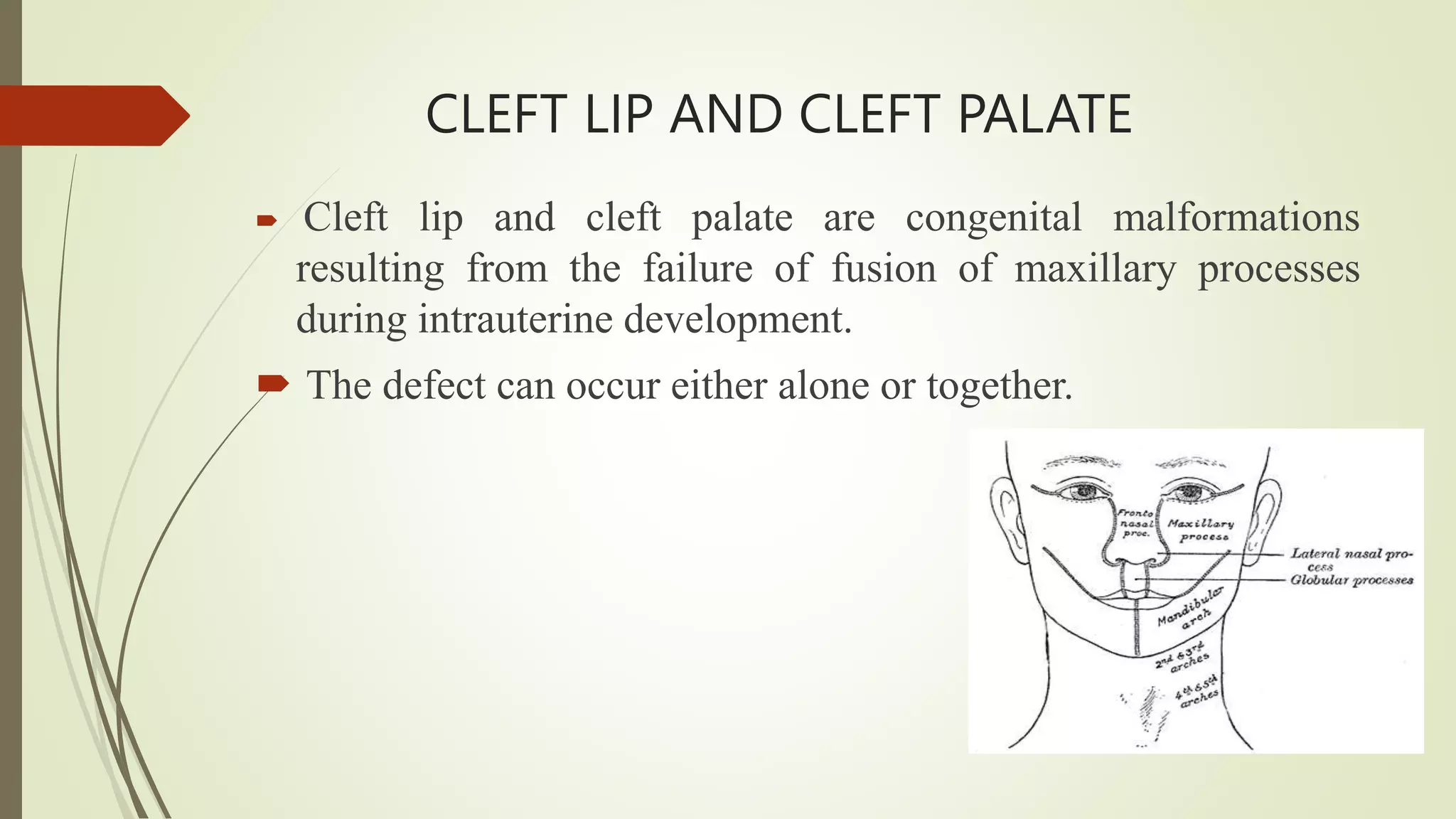 cleft lip and palate1.pptx