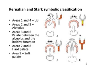 Cleft lip and palate | PDF