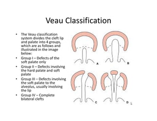 Cleft lip and palate | PPT