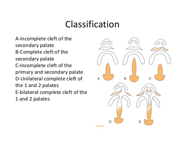 Cleft lip and palate