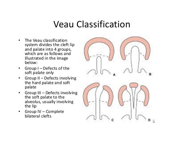 Cleft lipandpalate2read only