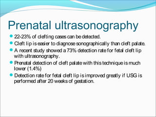 Cleft lip and palate | PPT