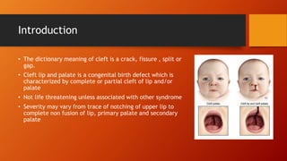 Cleft lip and palate and its management | PPT