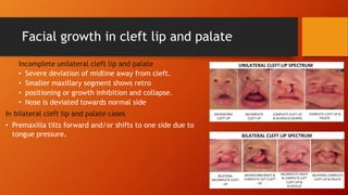 Cleft lip and palate and its management | PPTX
