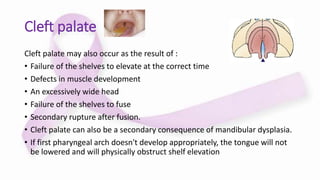 cleft lip and palate awareness.pptx