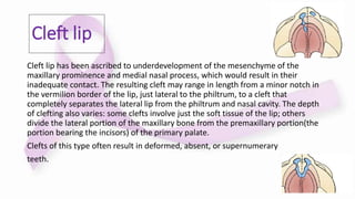 cleft lip and palate awareness.pptx