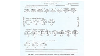 CLEFT LIP AND PALATE ETIOLOGY AND CLASSIFICATION.pptx