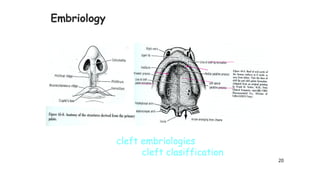 CLEFT LIP AND PALATE ETIOLOGY AND CLASSIFICATION.pptx