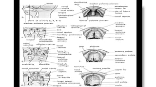 CLEFT LIP AND PALATE ETIOLOGY AND CLASSIFICATION.pptx
