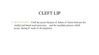 CLEFT LIP AND PALATE ETIOLOGY AND CLASSIFICATION.pptx