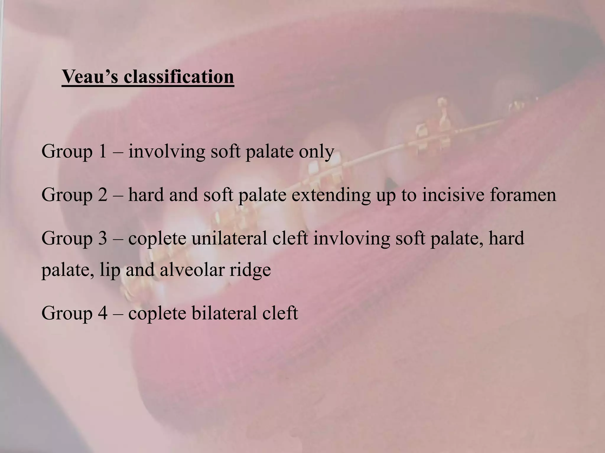 Cleft lip and palate O.ppt