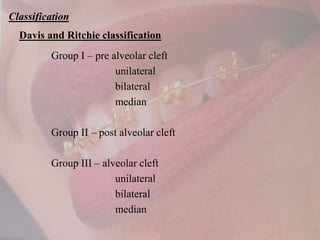 Cleft lip and palate O.ppt