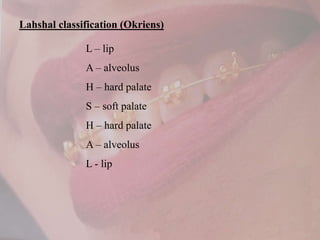 Cleft lip and palate O.ppt