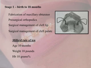 Cleft lip and palate O.ppt