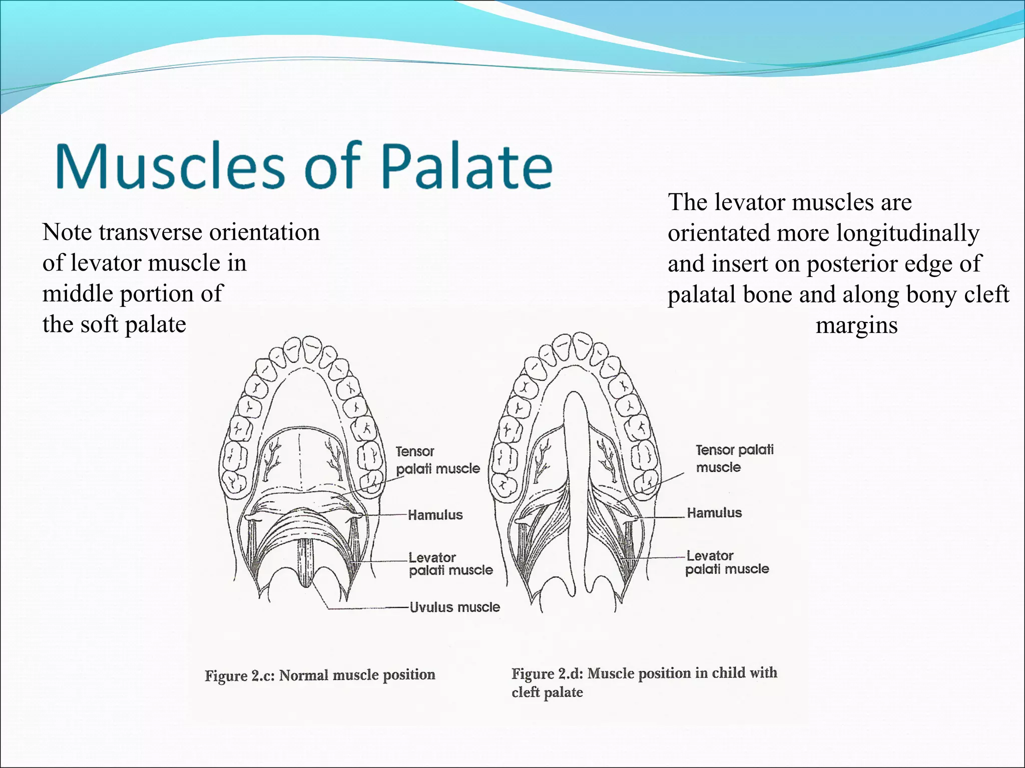 Cleft lip and palate ppt | PPT