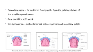 Management of CLEFT LIP AND PALATE SEMINAR | PPTX