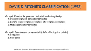 Management of CLEFT LIP AND PALATE SEMINAR | PPTX