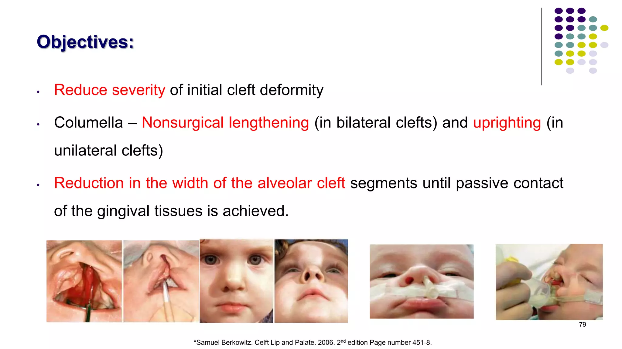 Cleft lip and palate slideshare | PPTX