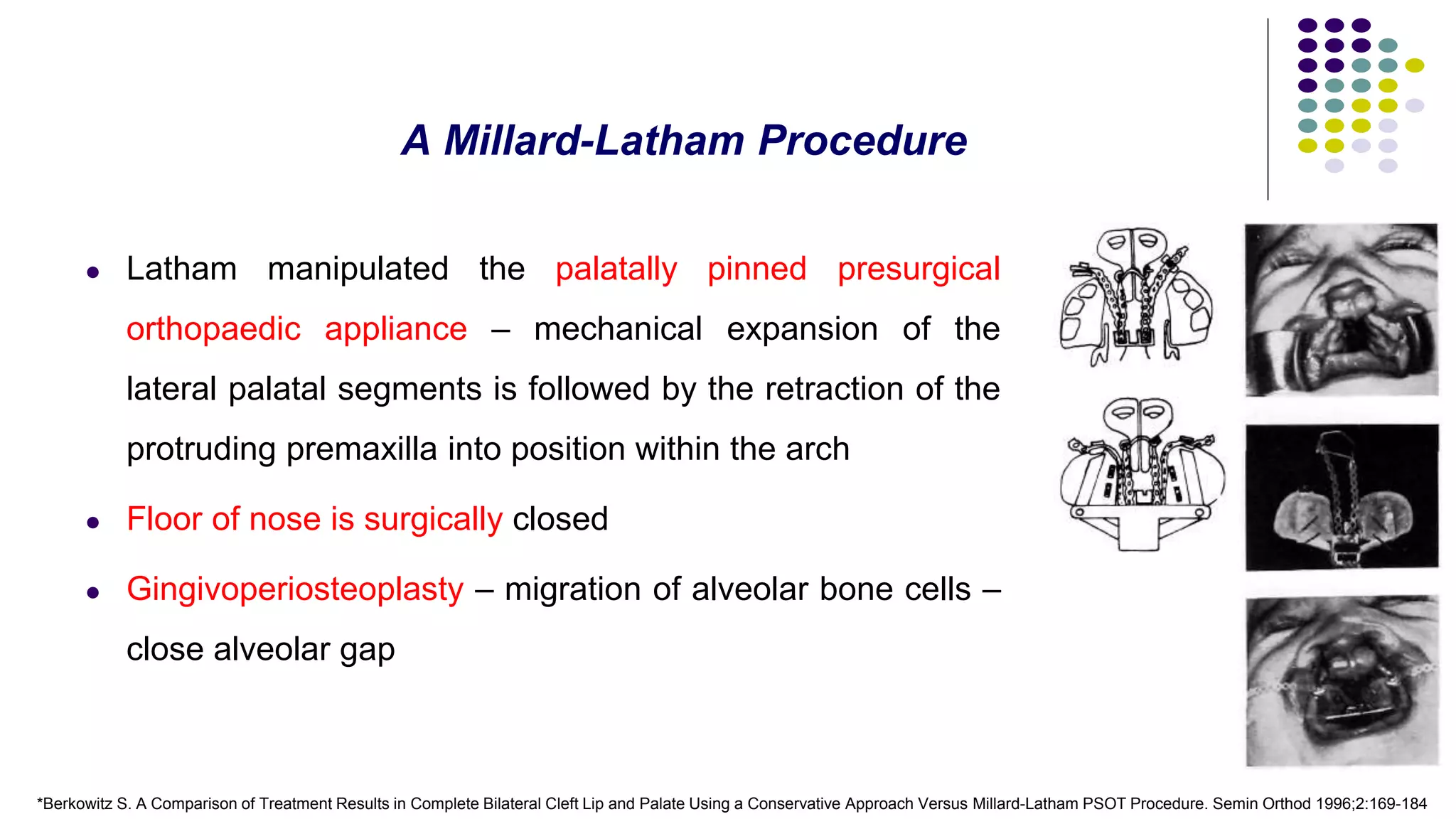 Cleft lip and palate slideshare | PPTX