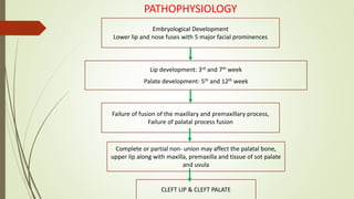 Cleft lip and cleft palate | PPTX