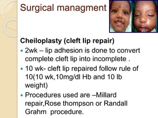 Cleft lip cleft palate | PPTX