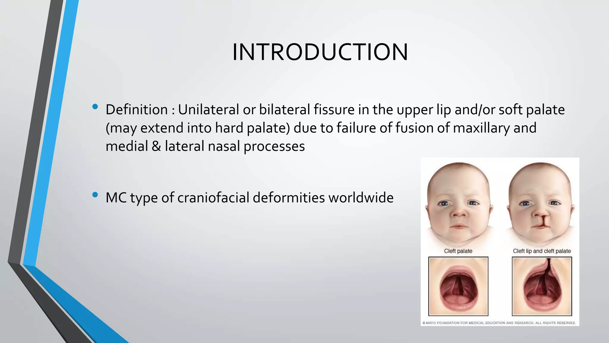 Anesthetic Management for Cleft Lip & Palate | PPTX