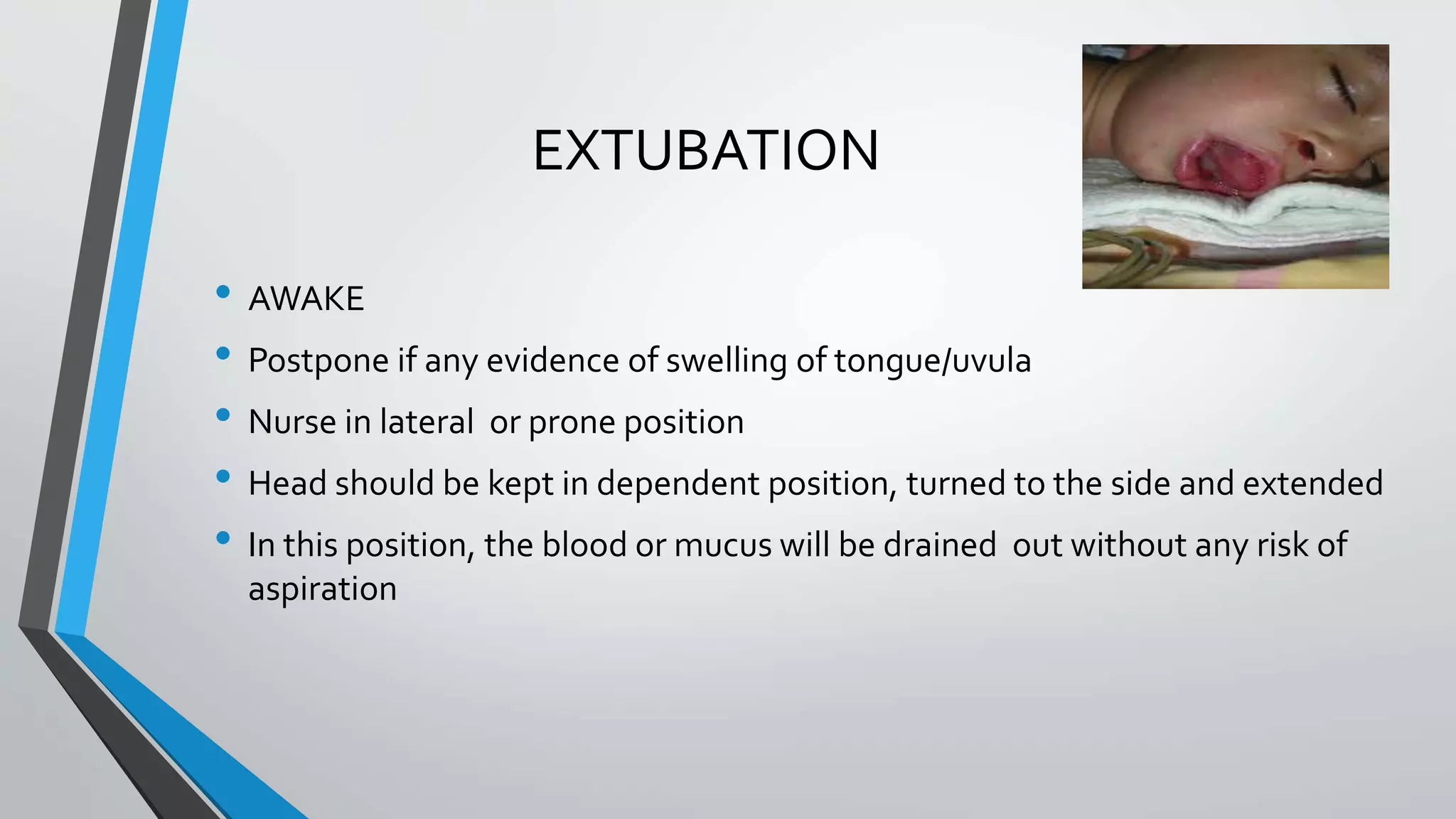 Anesthetic Management for Cleft Lip & Palate | PPTX