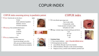 Anesthetic Management for Cleft Lip & Palate | PPT
