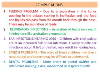 CLEFT LIP & CLEFT PALATE / paediatric .. | PPT