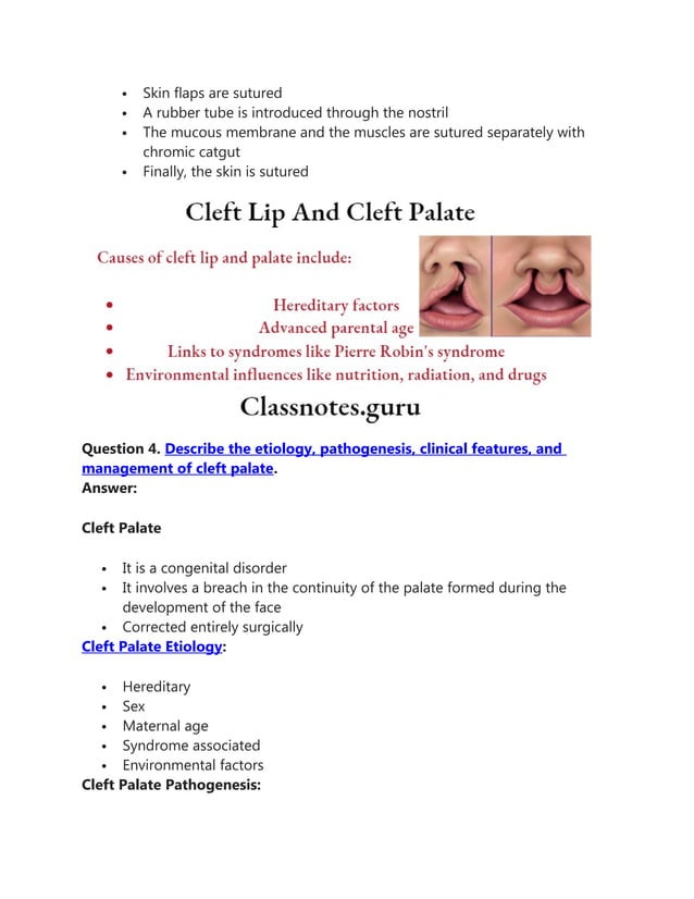 Cleft Lip & Cleft Palate Causes & Treatment.docx