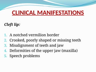 cleft lip n.pptx genetic disorders cleft lip | PPT