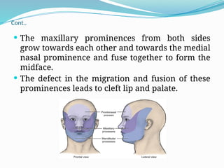 cleft lip n.pptx genetic disorders cleft lip | PPTX