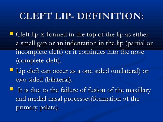 Palatable Definition