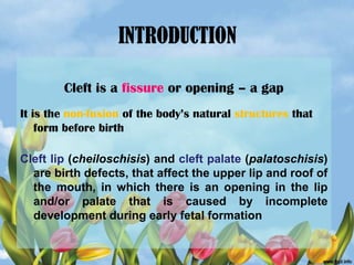 Cleft lip & palate | PPSX