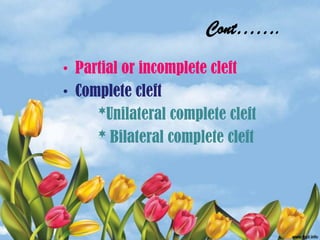 Cleft lip & palate | PPSX