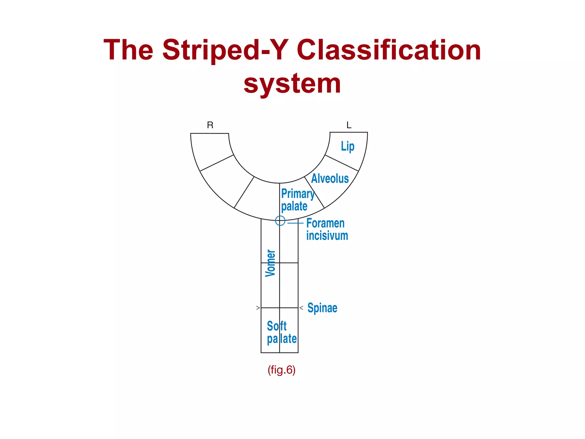 Cleft lip & Cleft palate | PDF